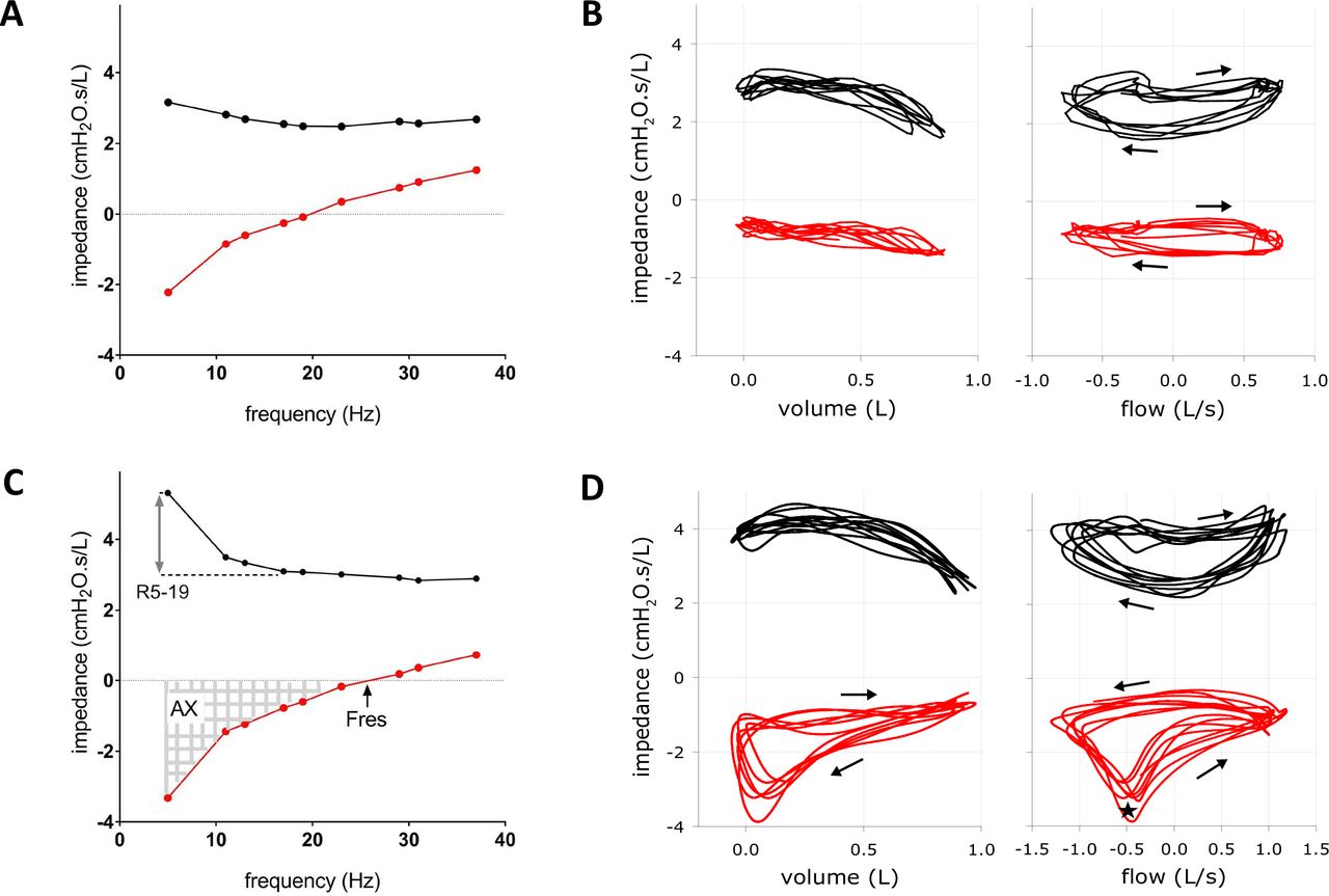 Standard pulmonary function tests and respiratory oscillometry patterns ...
