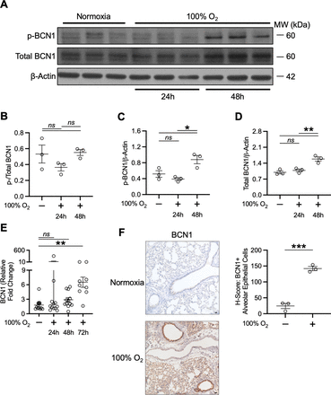 Epidermal growth factor receptor regulates Beclin-1 in hyperoxic acute ...
