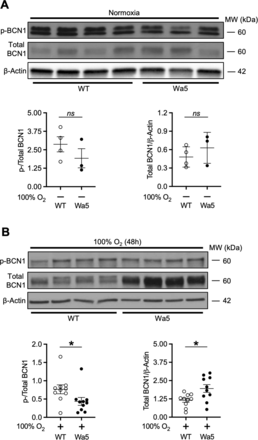 Epidermal growth factor receptor regulates Beclin-1 in hyperoxic acute ...